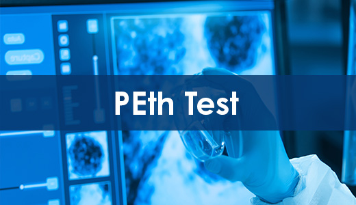 PEth Test - ARCpoint Labs